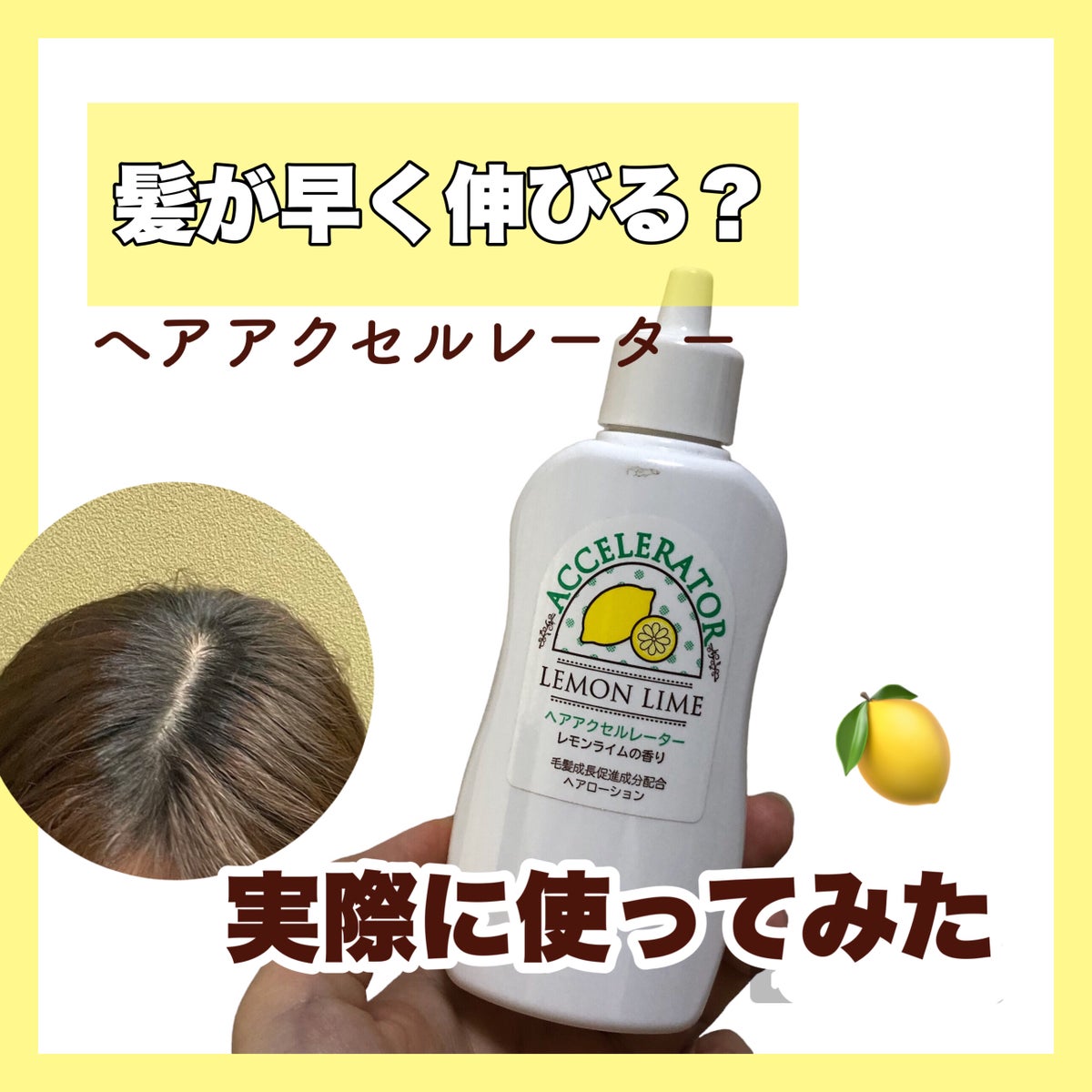ヘアアクセルレーター レモンライムの香り|加美乃素本舗の口コミ 早く伸びる?ヘアローション🧴 実際に2ヶ月試してみました! By うさぴ