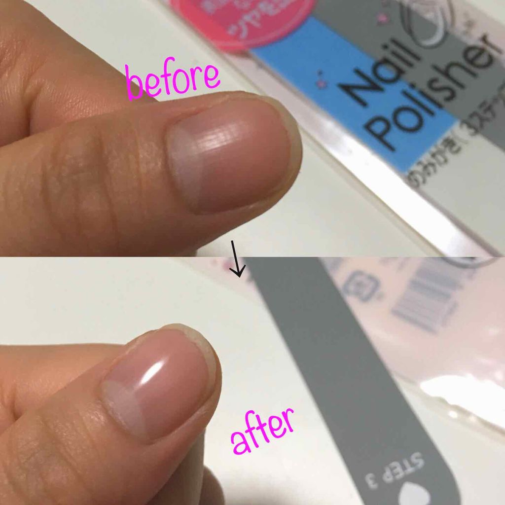 つめみがき|daisoの口コミ 超優秀!100均で買えるおすすめネイル用品!ちょっと擦るだけで差は歴然 By Nana混合肌20代