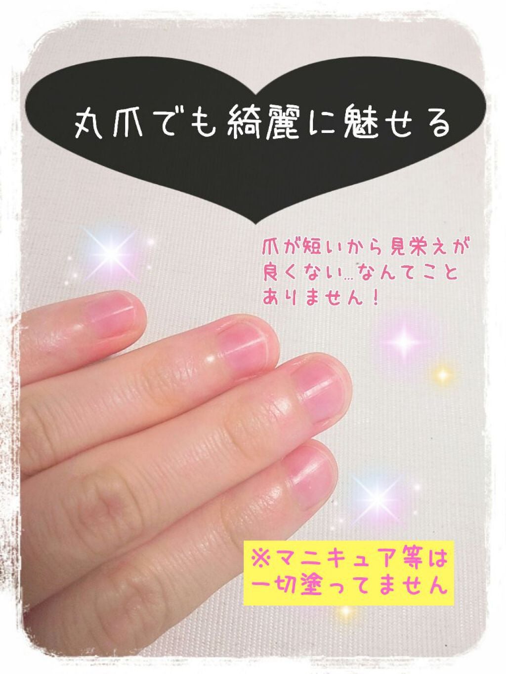 爪美活ネイルオイル|daisoの口コミ「超優秀!100均で買えるおすすめネイルオイル・トリートメント! ••┈┈┈┈┈ 丸爪だって綺麗になれる
