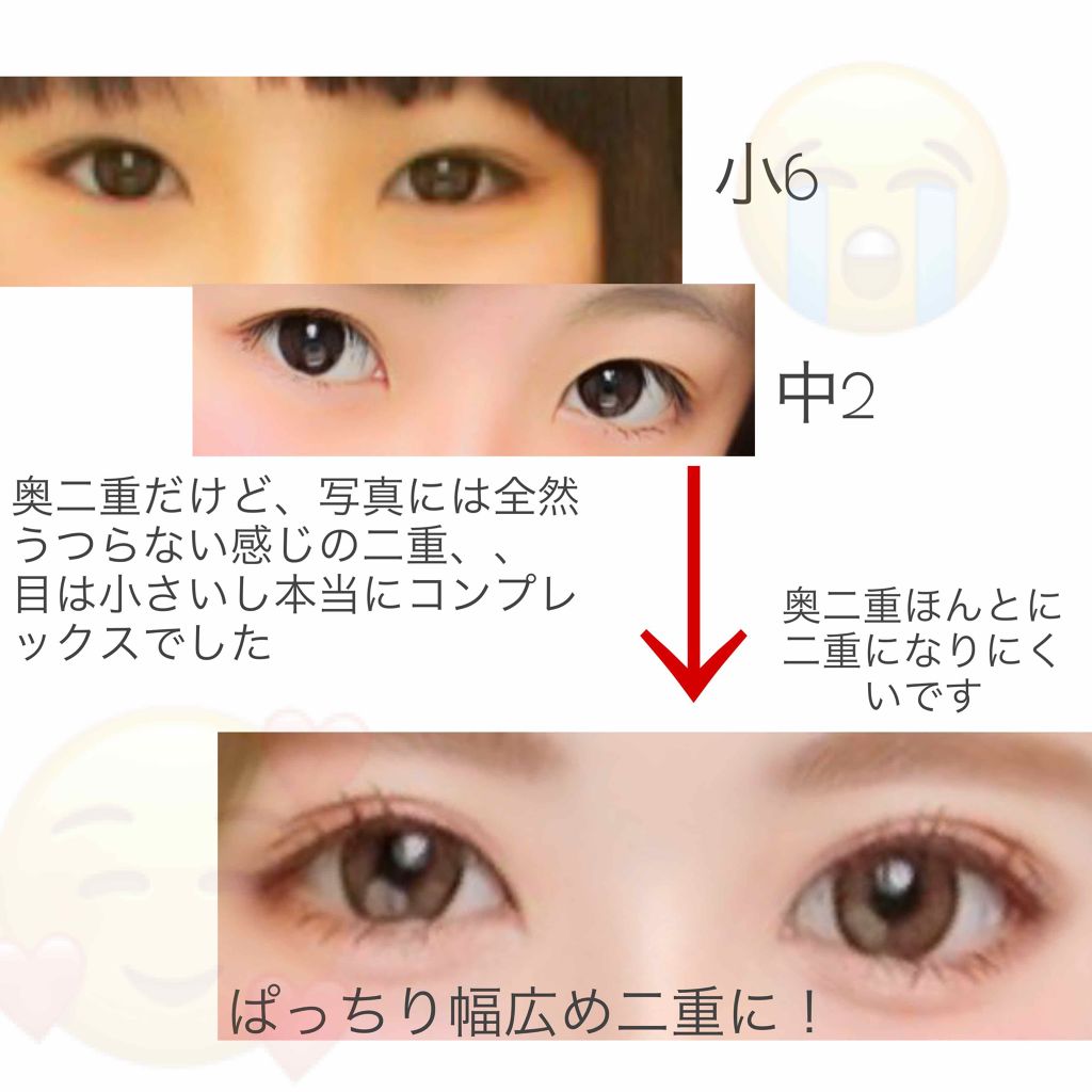 Automatic Beauty・daiso・セリアの二重まぶた用アイテムを使った口コミ 今回は私が二重になった話をしたいと思います By