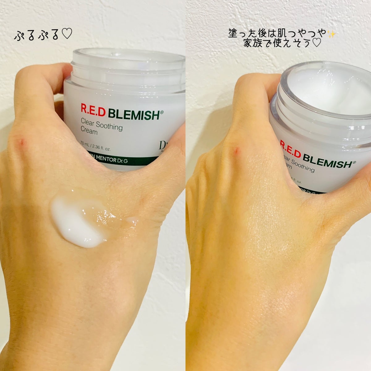 レッドブレミッシュ クリアスージングクリーム|drgの口コミ Pr Drg レッドブレミッシュ By 🐰🌷ろむ 🌷🐰混合肌 Lips