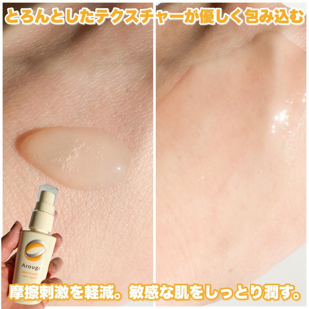 スキントラブルケア リキッド|アルージェの口コミ 敏感肌におすすめの美容液!製薬会社のこだわりがぎゅっ! By Riho 集英社