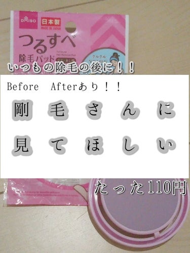 【試してみた】つるすべ除毛パッド Daisoのリアルな口コミ・レビュー Lips