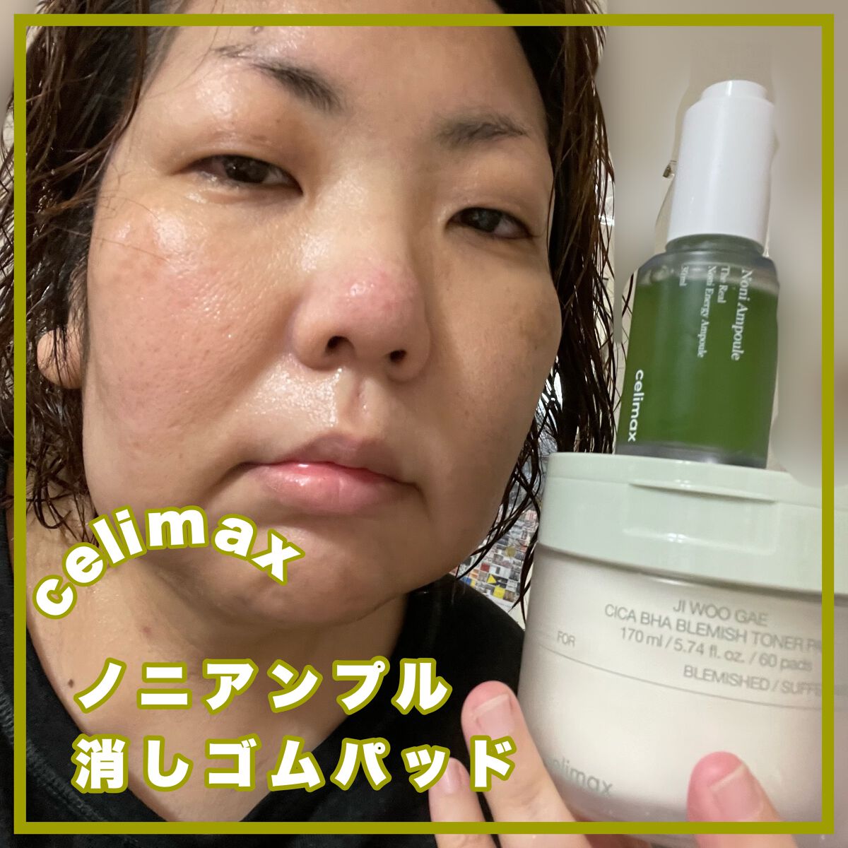 Celimaxのスキンケア・基礎化粧品 Bha消しゴムピーリングパッド&noni Ampuleを使った口コミ セリマックス様の ノニアンプル