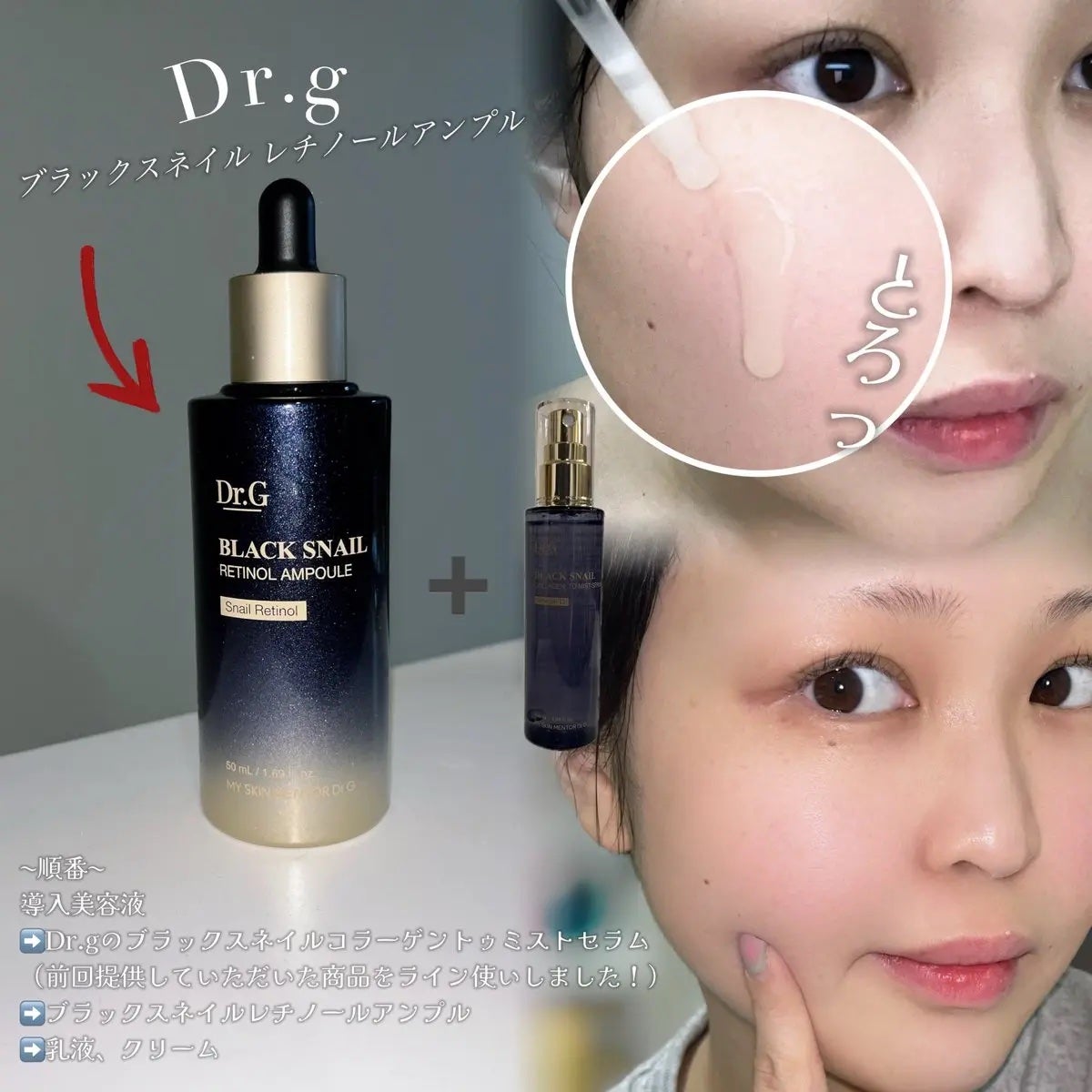 ブラックスネイルレチノールアンプル|drgの口コミ Pr 【drgjpofficial 】様より商品を提供して頂きました♡ By