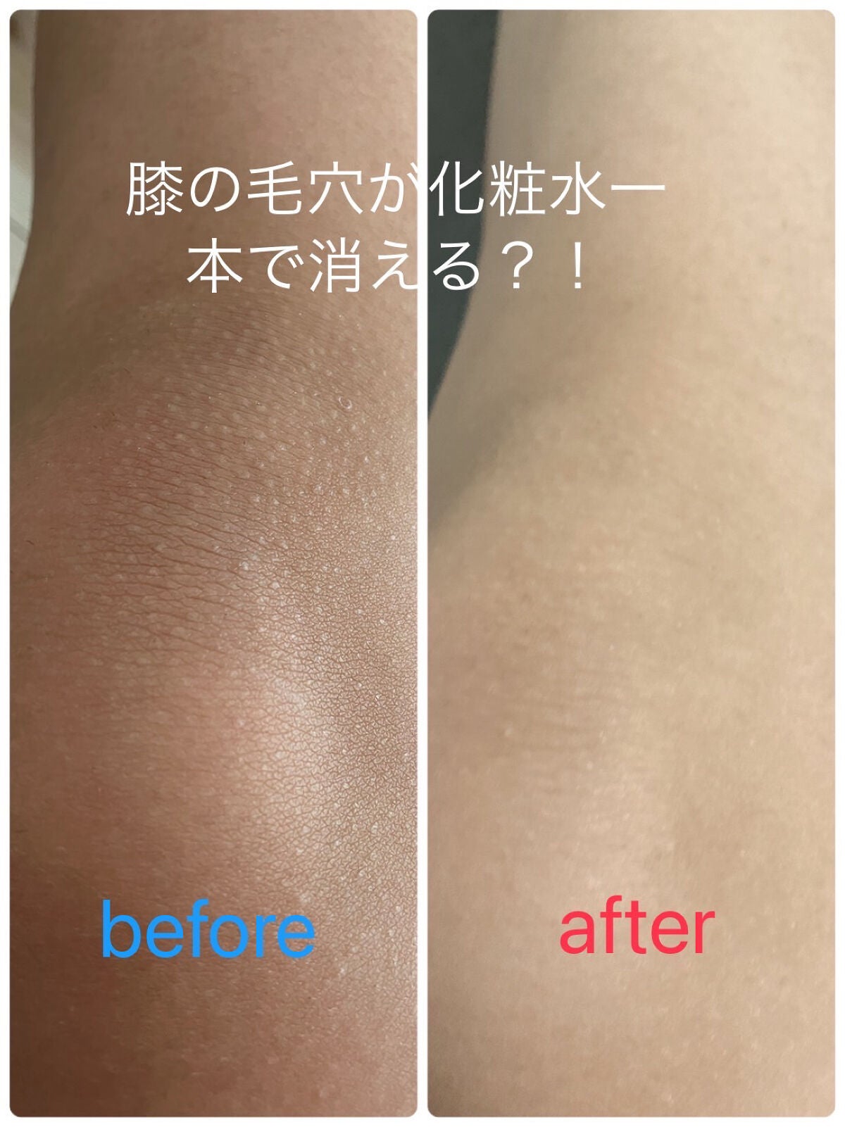 ハトムギ化粧水ナチュリエ スキンコンディショナー R |ナチュリエの使い方を徹底解説 初投稿です!これからよろしくお願いします! By