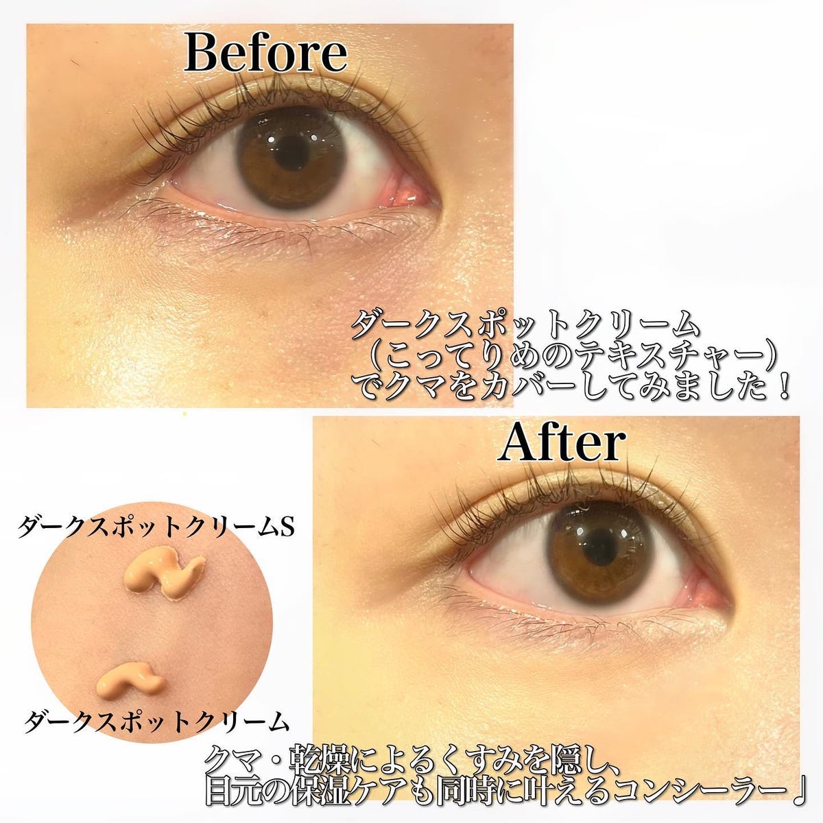 クマカバーアイクリーム|eyelenolの口コミ アイレノール ダークスポットクリームs(こってりめのテキスチャー)and By 温 フォロバ