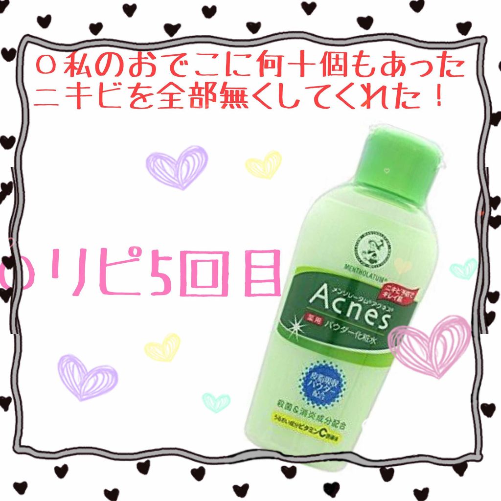 薬用パウダー化粧水|メンソレータム アクネスの口コミ 私は中学2年の時ニキビがピークでした! By ♡re I Ka♡ Lips