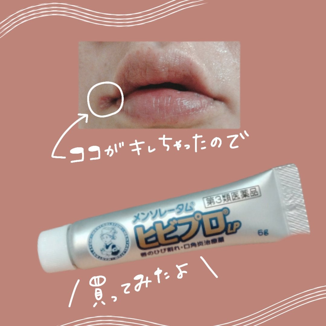 ヒビプロlp医薬品|メンソレータムの辛口レビュー 口の横がキレて痛いくうたろです🐶 By くうたろ混合肌30代前半 Lips