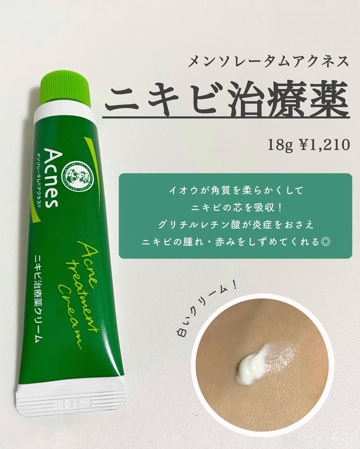 ニキビ治療薬医薬品|メンソレータム アクネスの使い方を徹底解説 【皮膚科の薬より効いた市販最強ニキビ薬🤍 By 白湯サユ