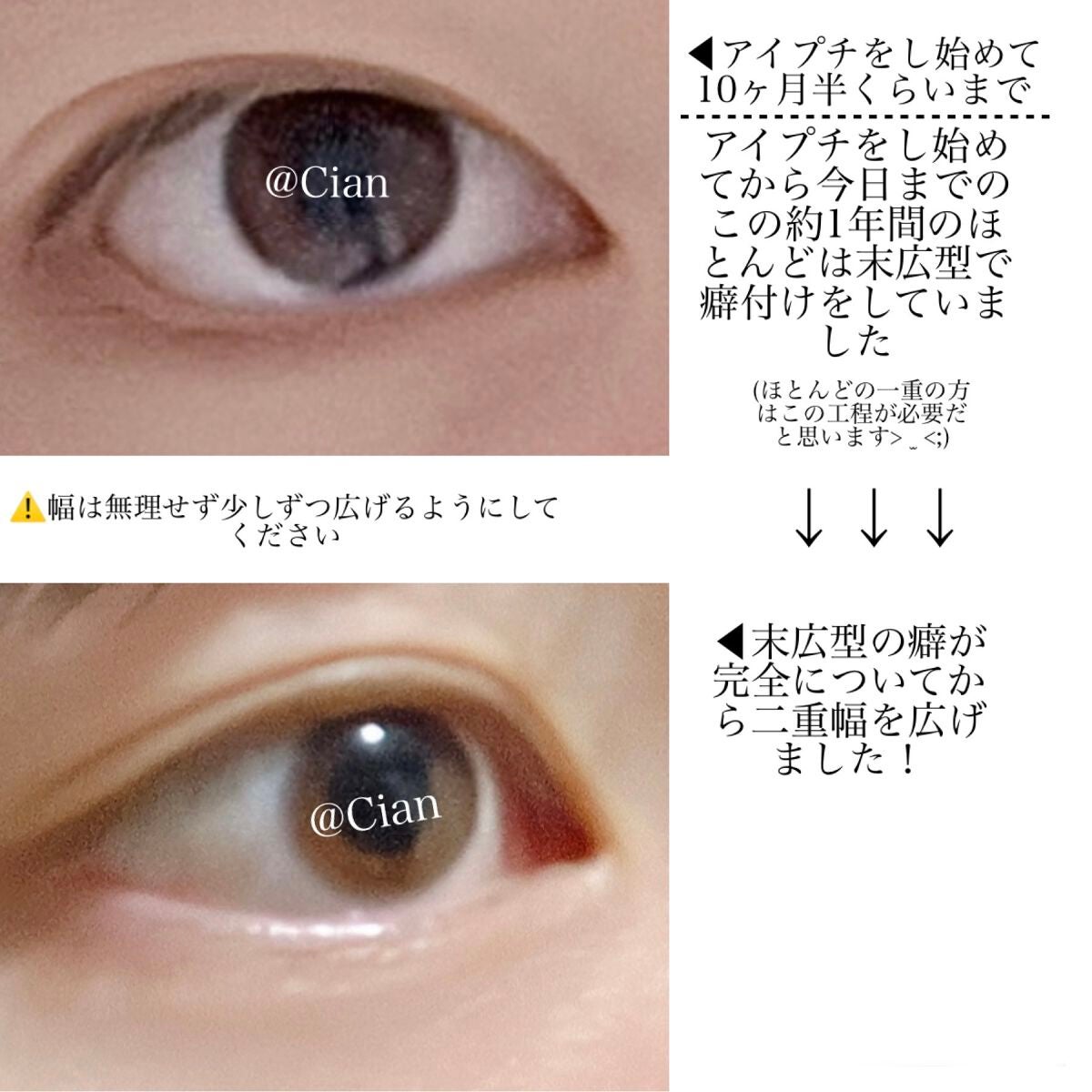 アイビューティー フィクサー Wp|アストレア ヴィルゴの口コミ 高校生のcianです😸 今回は《私流の二重の作り方》をご紹介します