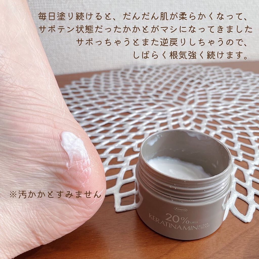 コーワ20%尿素配合クリーム医薬品|ケラチナミンの口コミ ケラチナミンコーワ20尿素配合クリーム By ひちゃまり【𝔹𝕖𝕒𝕦𝕥𝕪