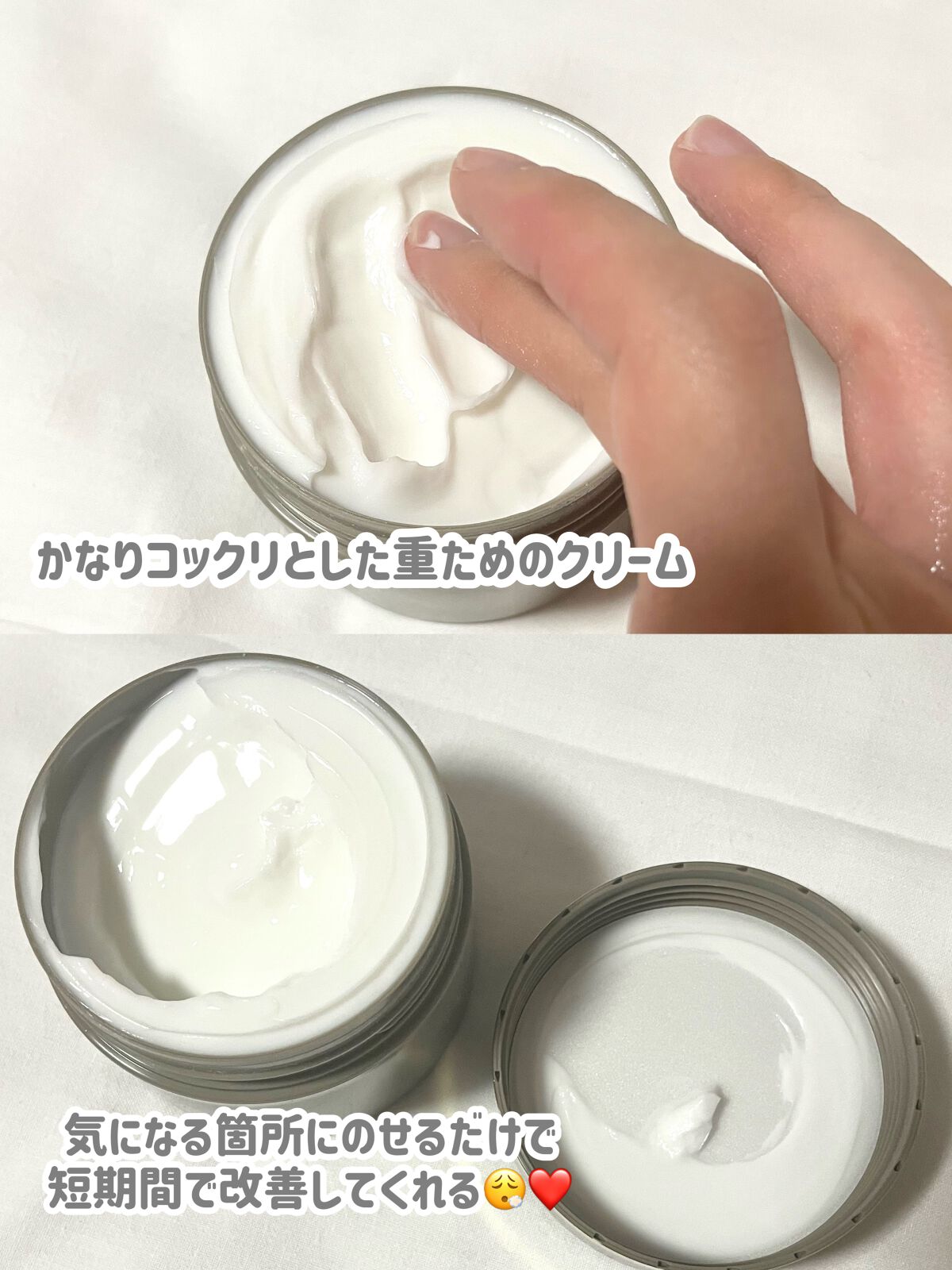 コーワ20%尿素配合クリーム医薬品|ケラチナミンの口コミ 全身の肌トラブルにはコレ ケラチナミン 20尿素配合クリーム By かみ