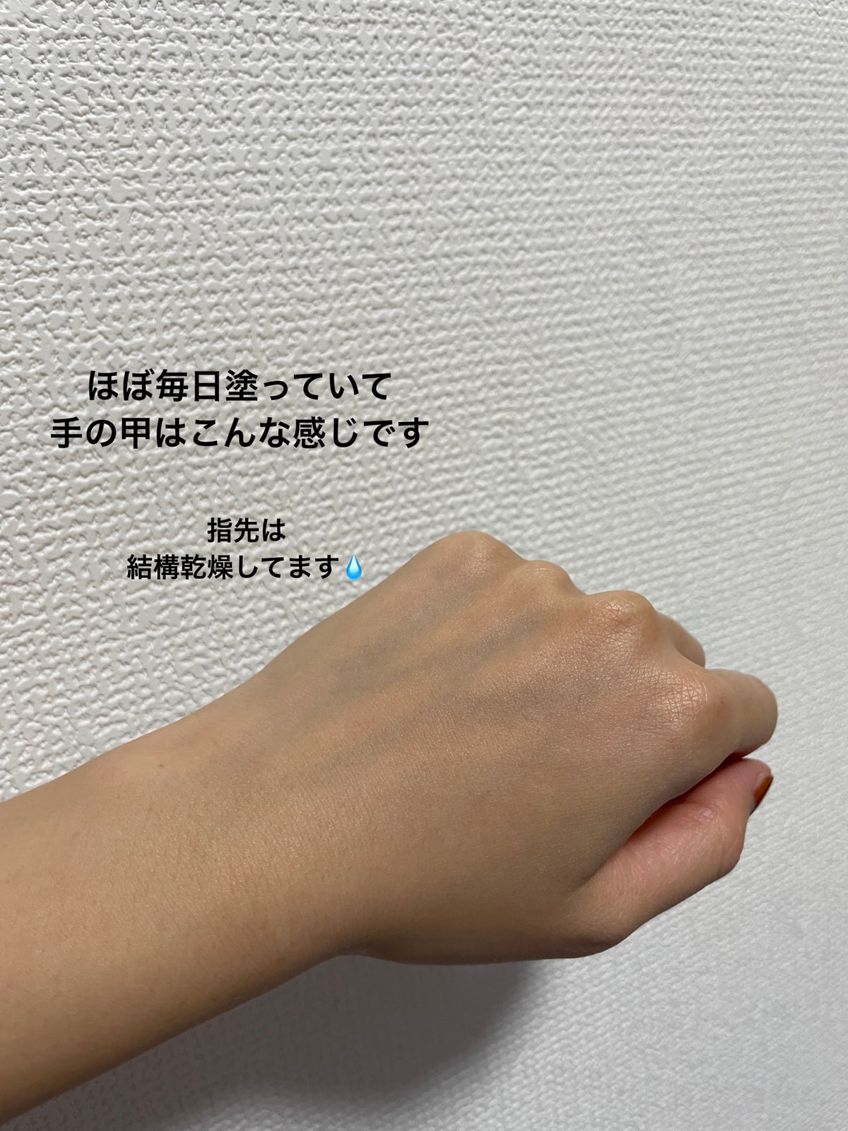 U20クリーム|メンタームの辛口レビュー 近江兄弟社 U20クリーム By ぱな脂性肌 Lips