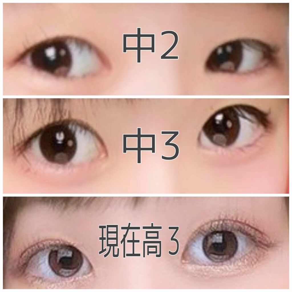 アイトーク・daisoの二重まぶた用アイテムを使った口コミ プリクラの進化と共に私の二重も進化してきたなぁ By ぽん乾燥肌20代前半