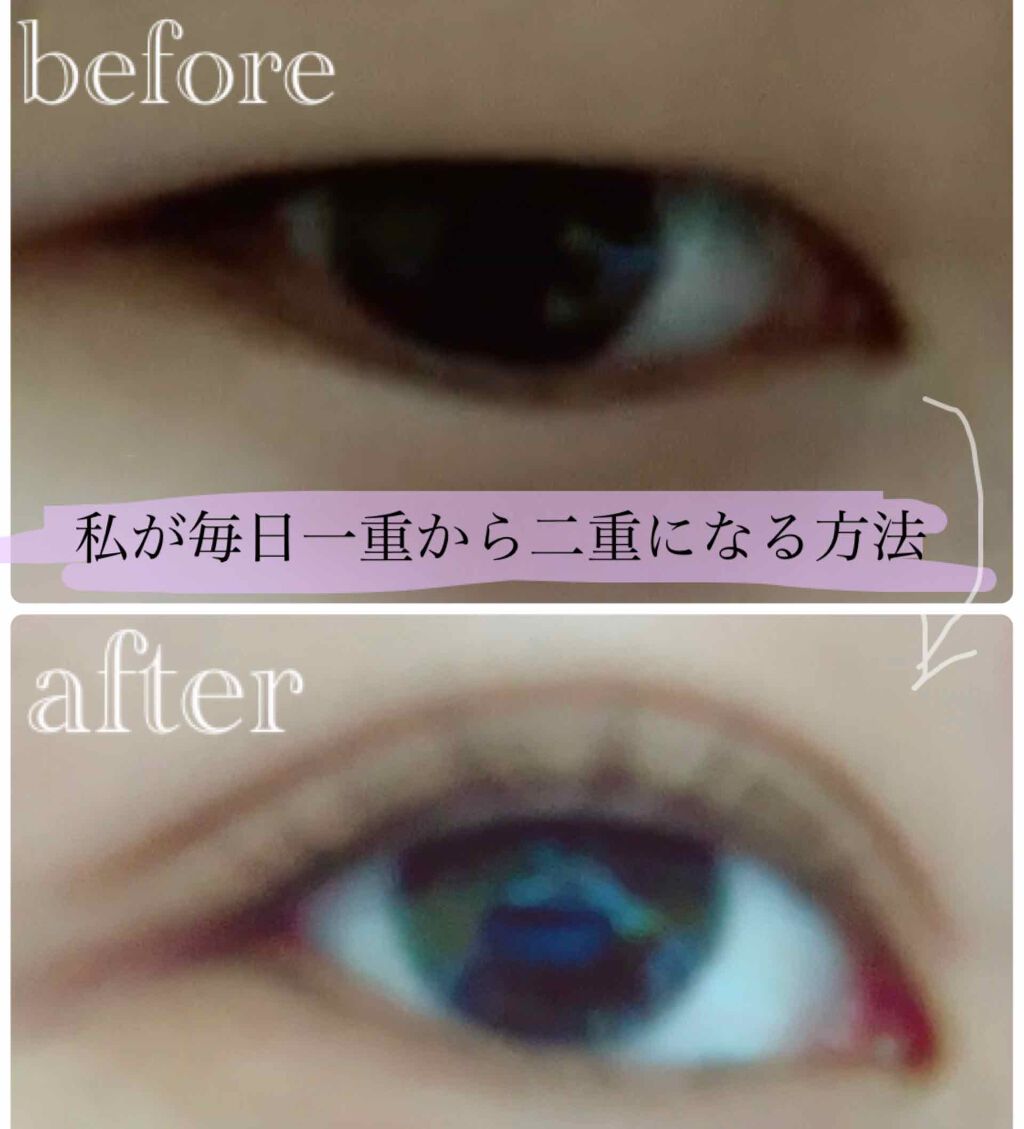《二重になる方法》ダブルアイリキッド|automatic Beautyの使い方や二重メイク 皆さんこんにちは!はじめまして😁 By れん