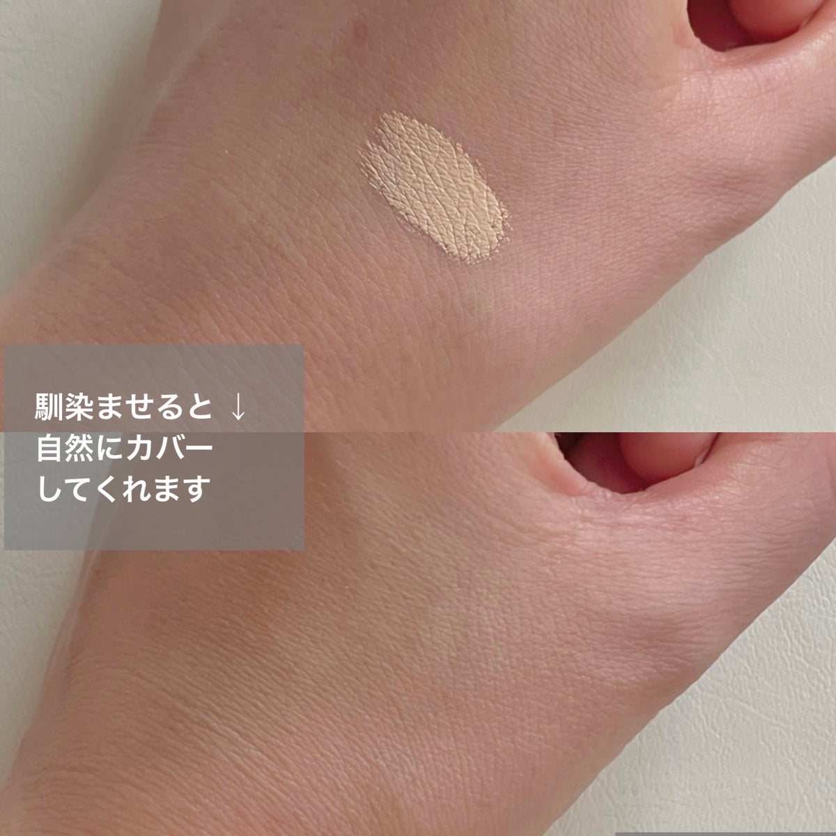 ダーマシンコンシーラー|23years Oldの効果に関する口コミ ニキビができやすい肌質なので By 077 フォロバ100敏感肌