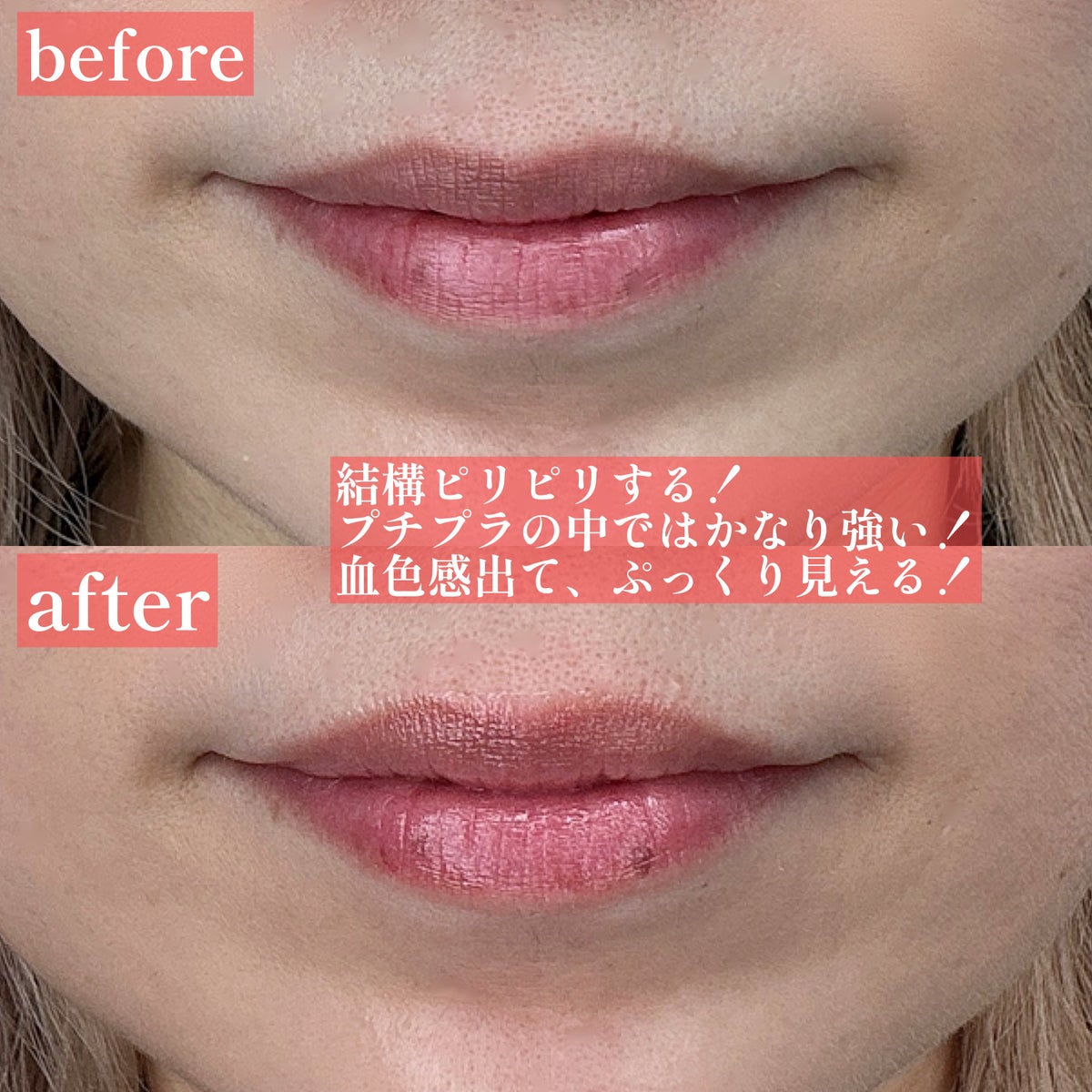 【限定リップケア・リップクリーム】リッププランパー ピリカラ|cipicipiの口コミ 名前の通り、ピリカラ‼️ピリピリ感強くてびっくりし