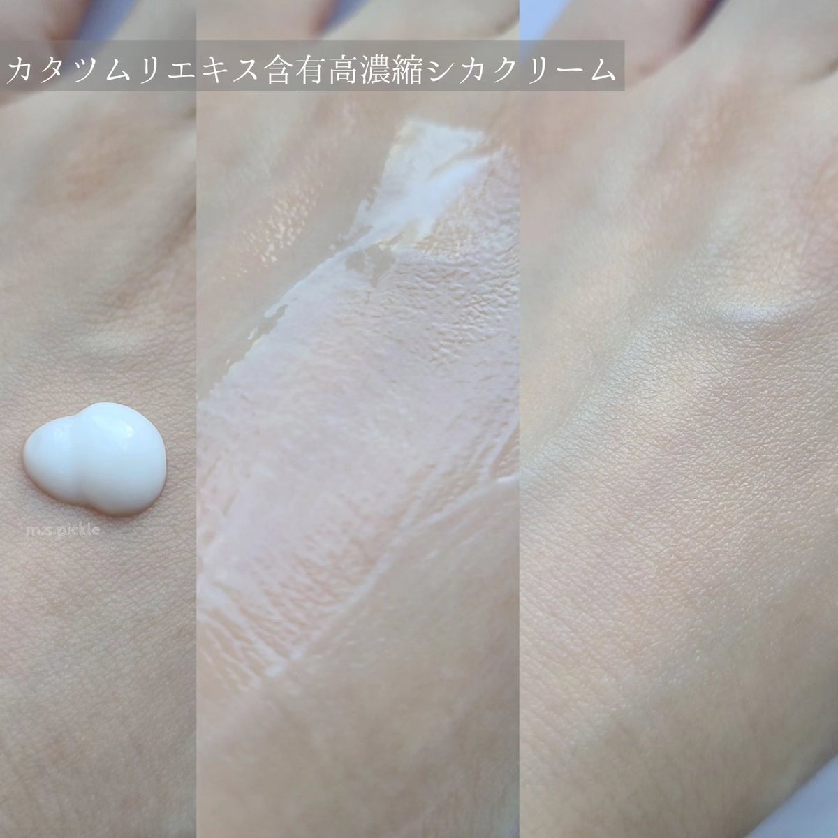 マジックカタツムリクリーム|ブランの効果に関する口コミ Blanc 【整肌成分のカタツムリエキス含有高濃縮シカクリーム】 By ピッ