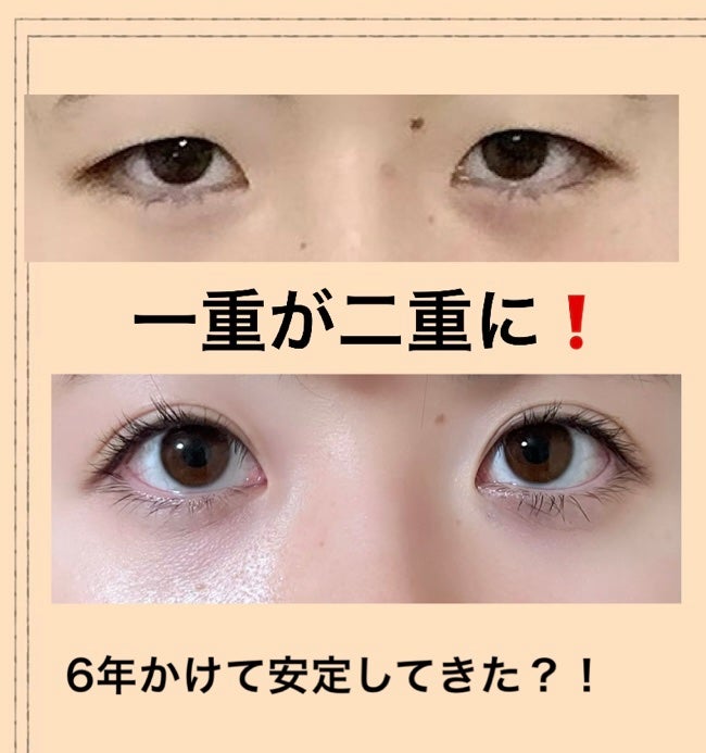 《二重になる方法》ワンダーアイリッドテープ Extra|d Upの使い方や二重メイク 重め一重から二重になった夜のアイプチの方法を教えます