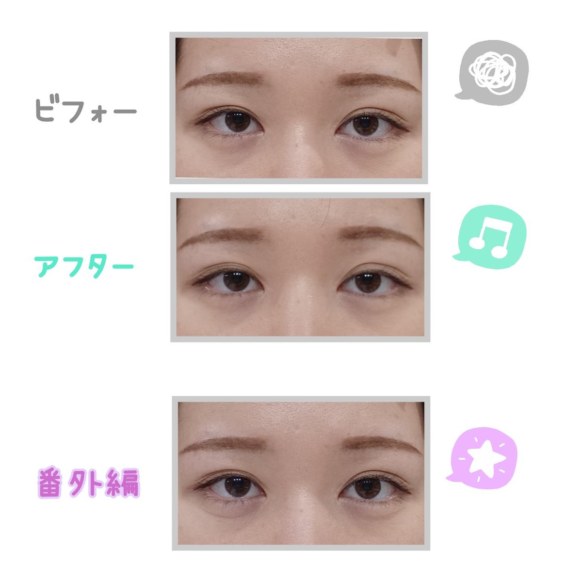 Twool ダブルアイリッドグルー|shobidoの口コミ Shobido Twool ダブルアイリッドグルー By Umi凹