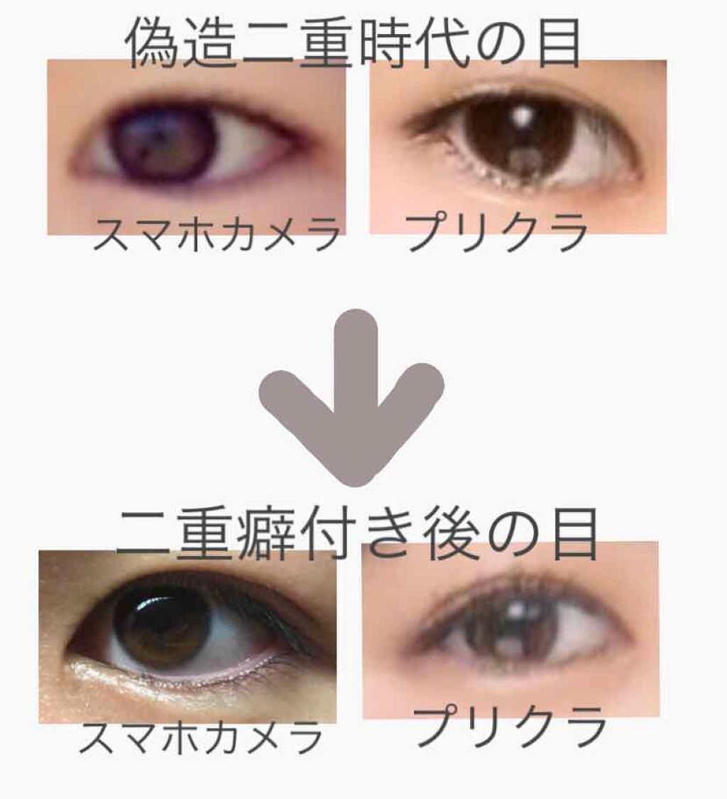 アイテープ 埋没式両面テープ|daisoの口コミ 超優秀!100均で買えるおすすめ二重まぶた用アイテム!投稿の内容を少し変えようと思って