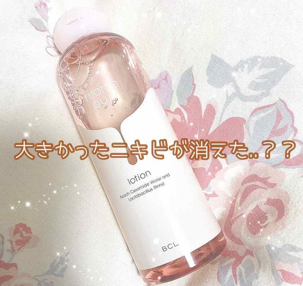 潤い化粧水|ももぷりの口コミ 乾燥肌におすすめの化粧水!ニキビがあっという間に消えた化粧水 By ℕ𝕒𝕟𝕒 ︎乾燥肌10代後半