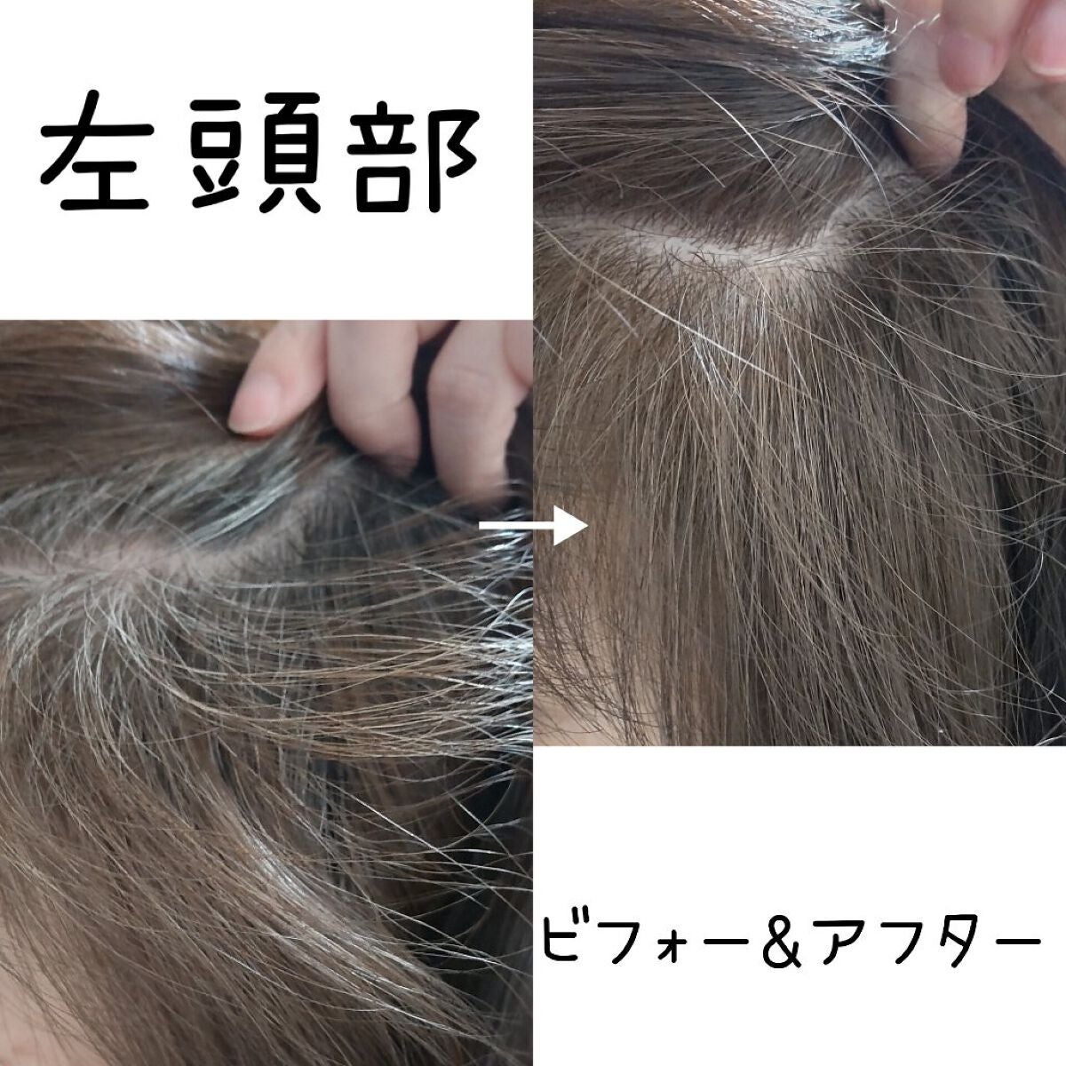 泡カラー 白髪用|ブローネの口コミ 昨日、毛染めしました。 ちょっと大事なお出掛け前にする By コンパス混合肌40代後半 Lips