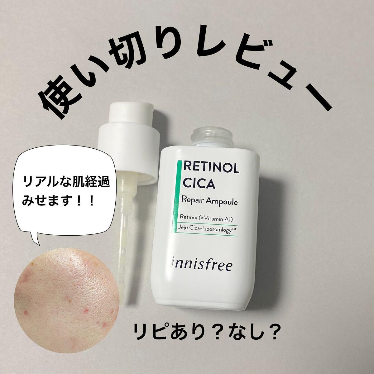 レチノール シカ リペア セラム|innisfreeの口コミ 使い切りレビュー Innisfree By あらいぐマン混合肌30代