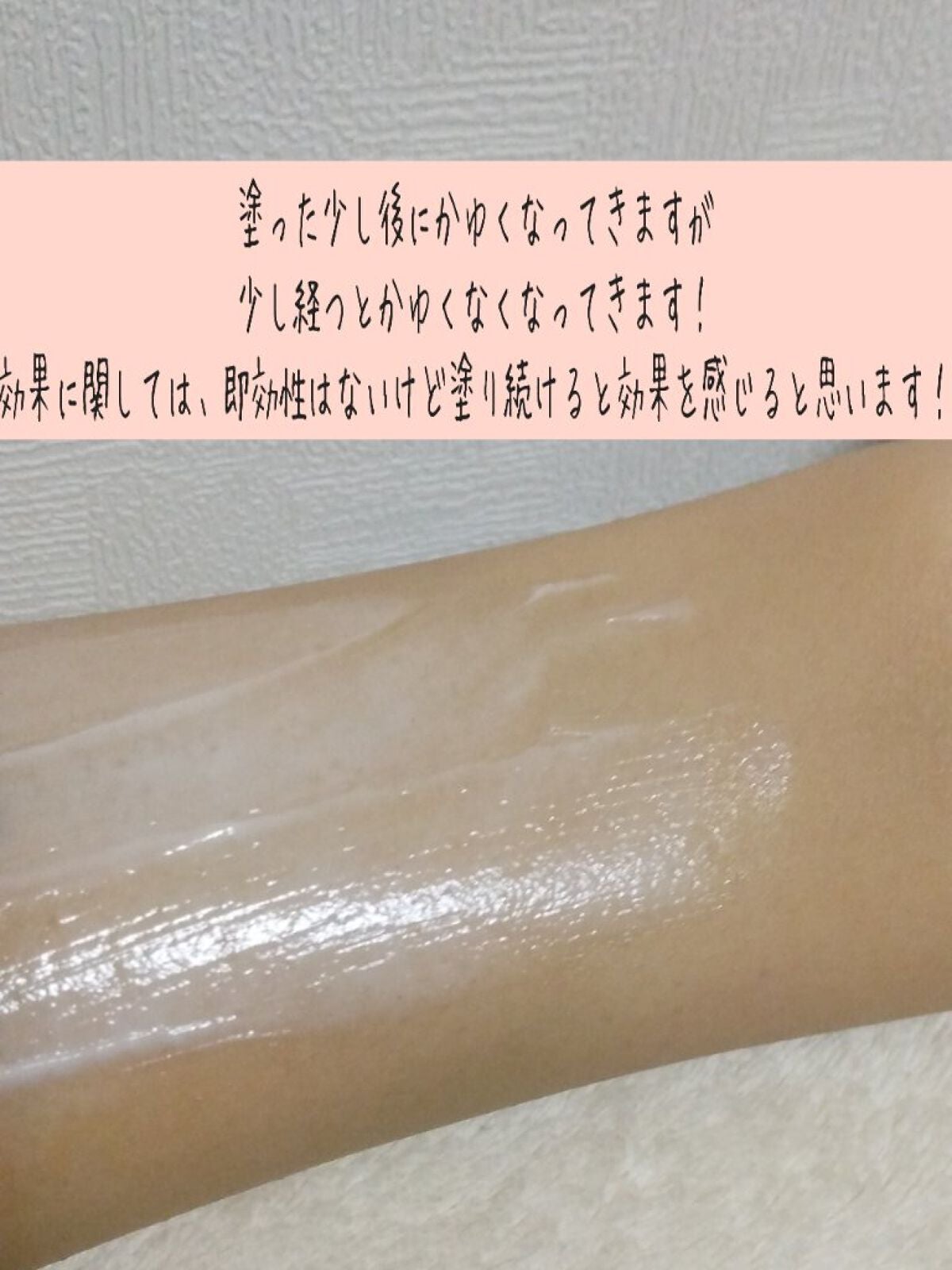 コーワ20%尿素配合クリーム医薬品|ケラチナミンの効果に関する口コミ 今日のlipsは、実際に効果を感じた尿素クリームの紹介です