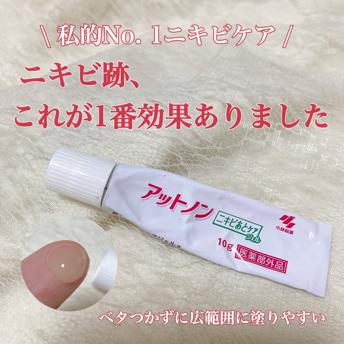 ニキビあとケアジェル|アットノンの効果に関する口コミ 私的にニキビ跡、これが1番効果ありました☝️ By こぐま敏感肌20代前半