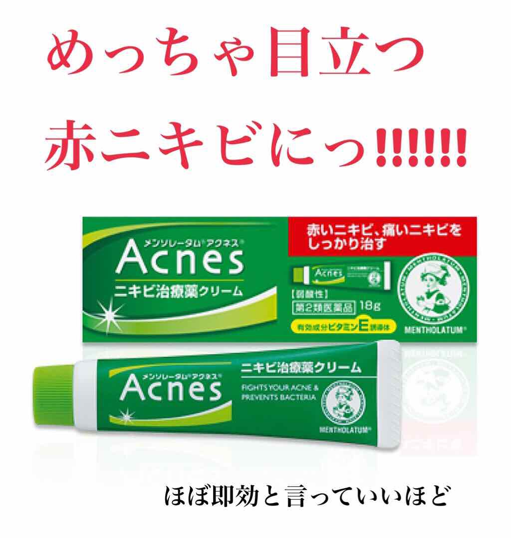 ニキビ治療薬医薬品|メンソレータム アクネスの効果に関する口コミ 『うわっ、赤ニキビなあなた By ぽに脂性肌 Lips