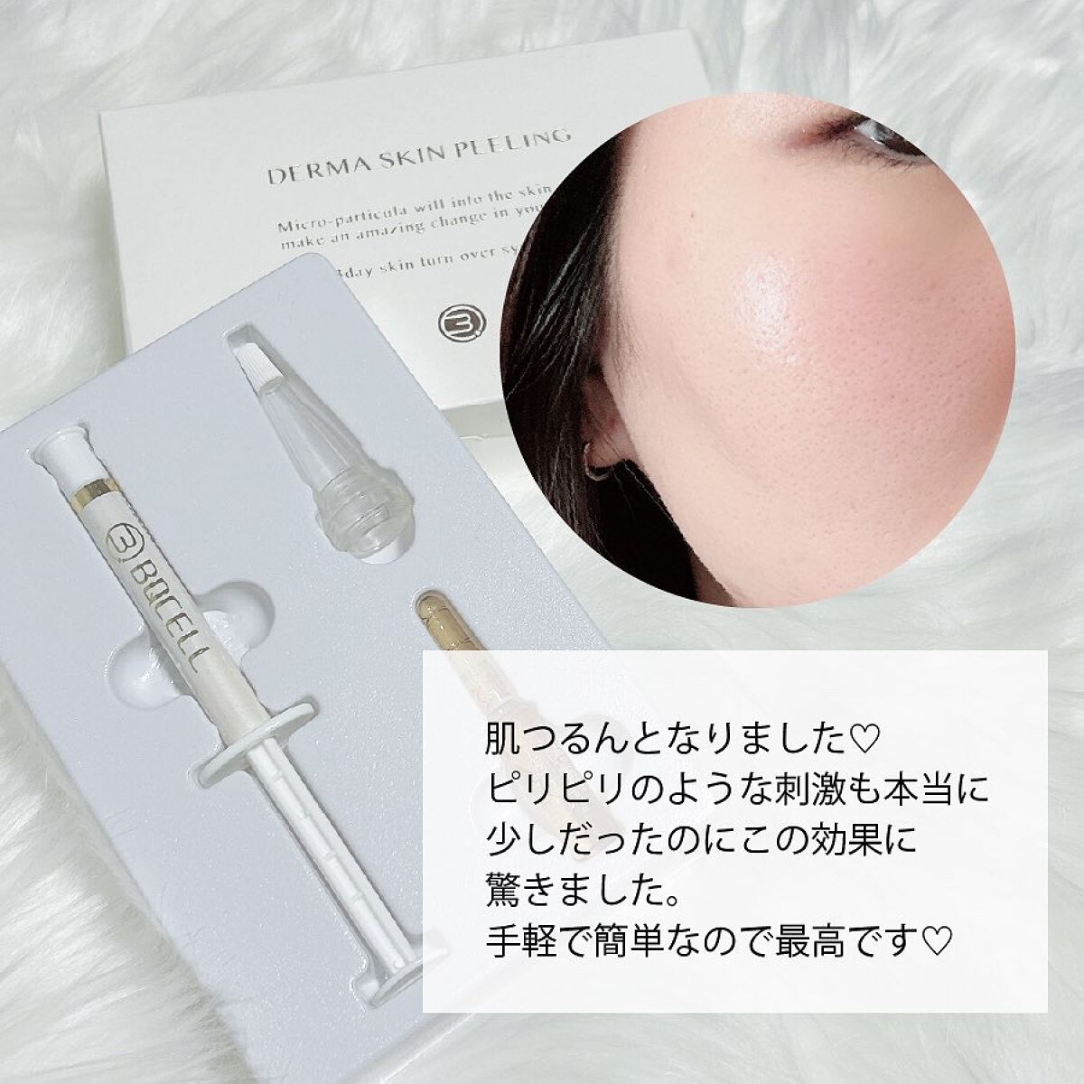 ダーマスキンピーリング|bqcellの使い方を徹底解説 ハーブピーリング お家で簡単にできる、塗って寝るだけのセルフピーリング! By