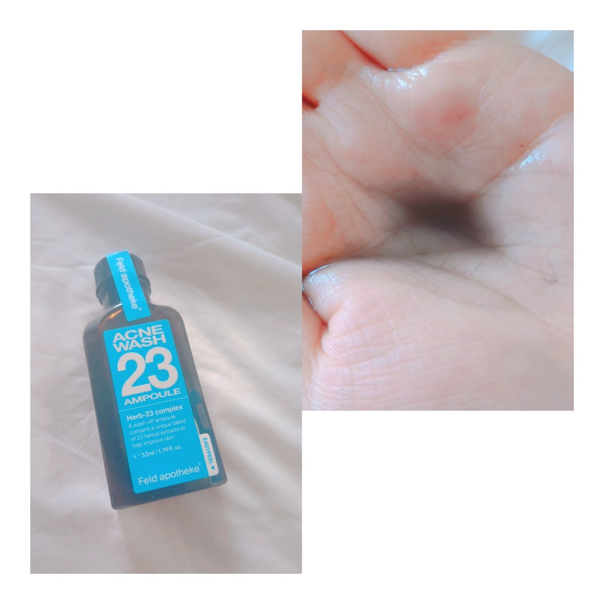 アクネウォッシュ23アンプル|feld Apothekeの効果に関する口コミ Feld Apothekeアクネウォッシュ23アンプル By