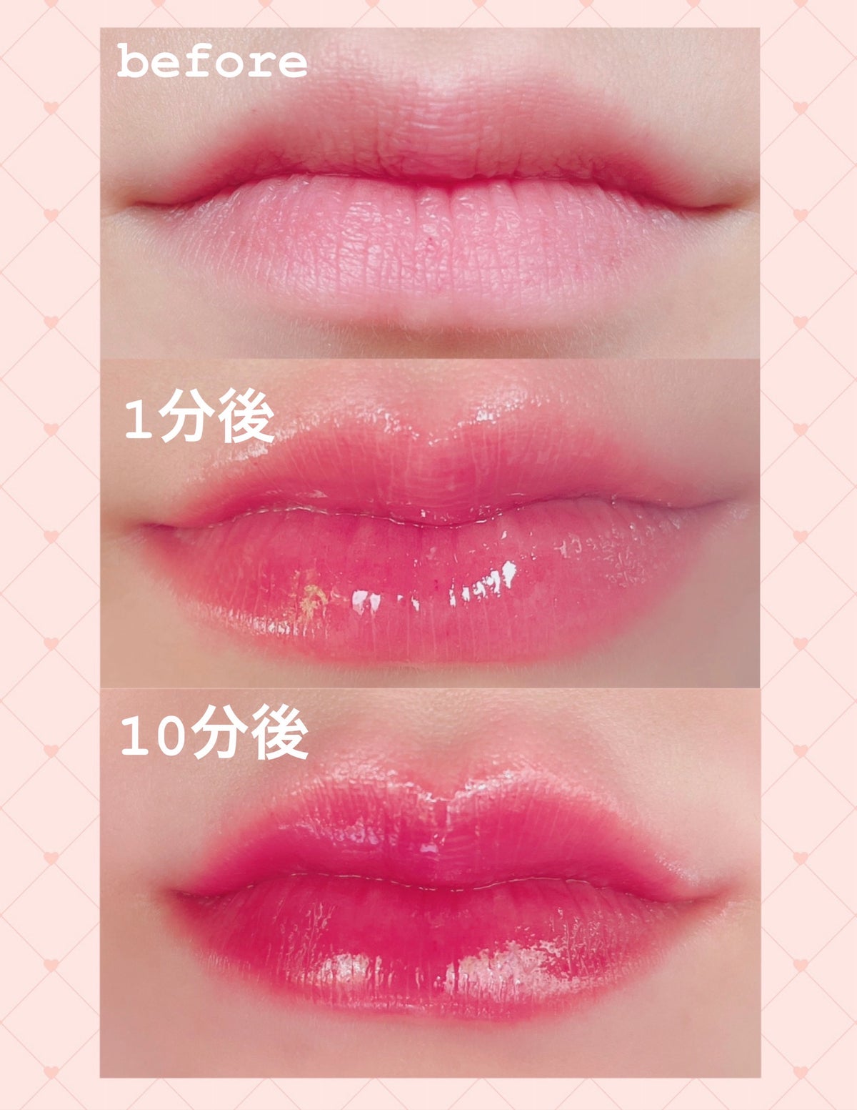 ボリュームリッププランパー|banila Coの口コミ Banilaco ボリュームリッププランパー By ぱち敏感肌 Lips