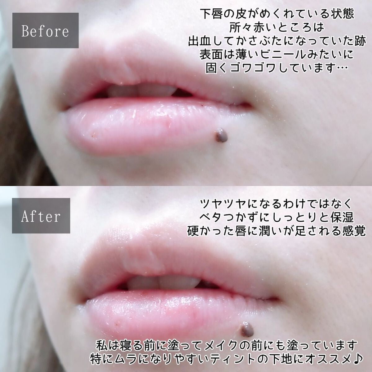 リップケア クリーム|キュレルの口コミ 荒れて固くなりがちな唇に 唇の治安維持にオススメのリップクリーム ️ By サツキ🎮敏感肌30