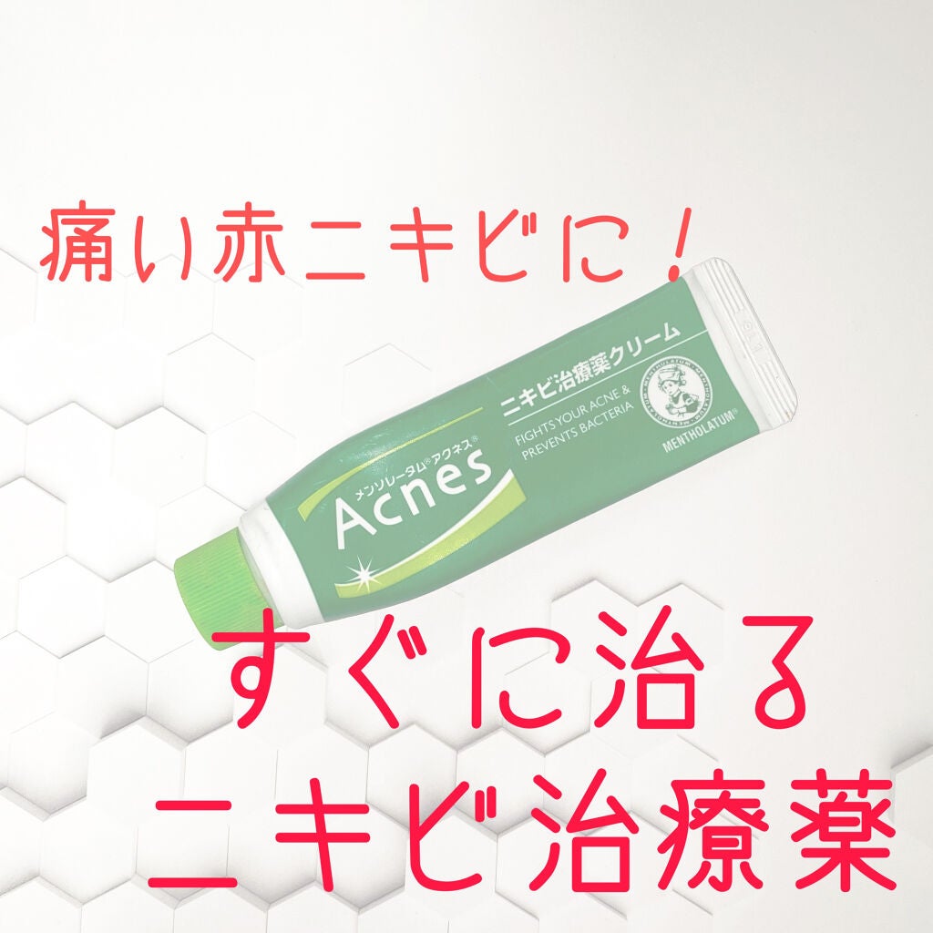 ニキビ治療薬医薬品|メンソレータム アクネスの使い方を徹底解説 痛い赤ニキビに!すぐに治るニキビ治療薬 By 望楓普通肌20代前半