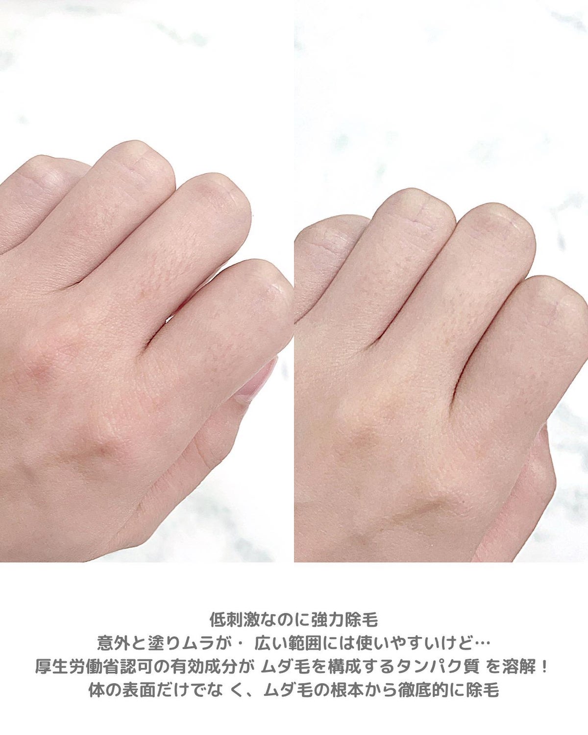 Delemo Point Fit|コスモビューティーの効果に関する口コミ 夏の必需品!美白効果も!ピンポイントで除毛 By あずさスキン