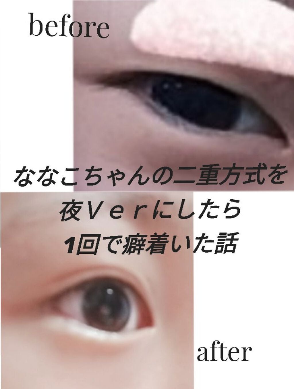 Daiso・アイトークの二重まぶた用アイテムを使った口コミ ななこちゃんの昼間のアイプチ仕方をしてみたら二重になった話 By まる Lips