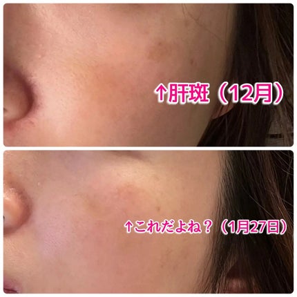 試してみた】AGE-R ブースタープロ MEDICUBEのリアルな口コミ 試してみた】AGE-R ブースタープロ MEDICUBEのリアルな口コミ