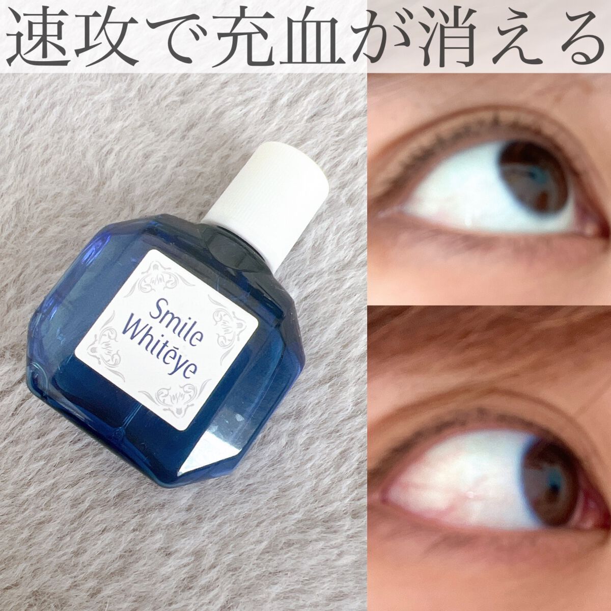 スマイルホワイティエ医薬品|ライオンの口コミ 何度もリピしているスマイルホワイティエの目薬😀 By Mamiru脂性肌30代後半