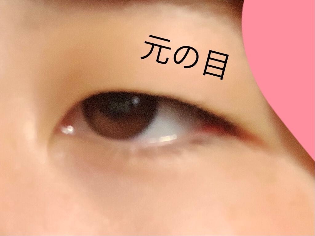 D Up・アイトークの二重まぶた用アイテムを使った口コミ 激重一重さん、一重さん、奥二重さん必見 By あめちゃん脂性肌20代前半