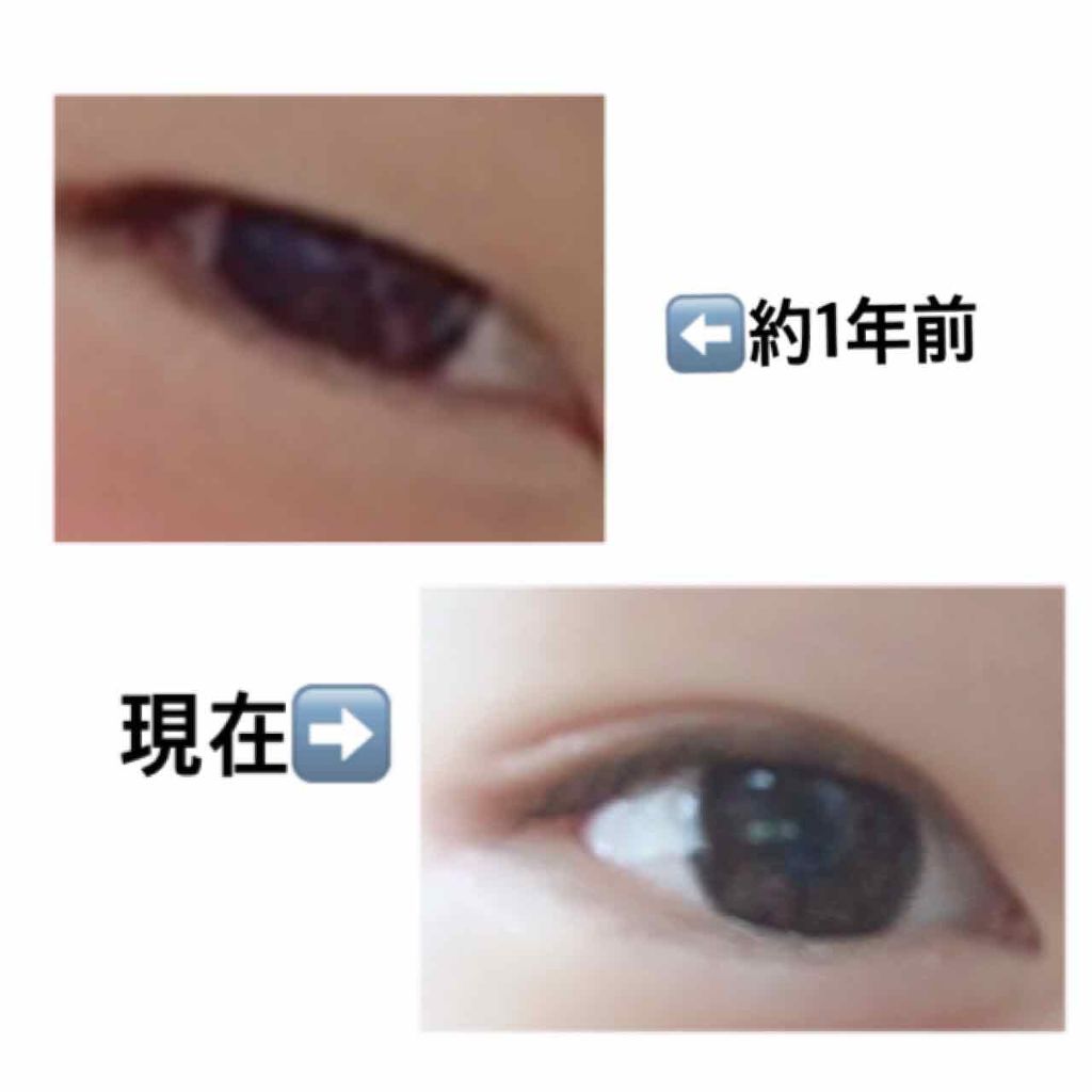 アイトーク|アイトークの口コミ 二重?の作り方〜 ほんとは誰にも言いたくない🤫 By 🍅トマト🍅混合肌10代前半 Lips