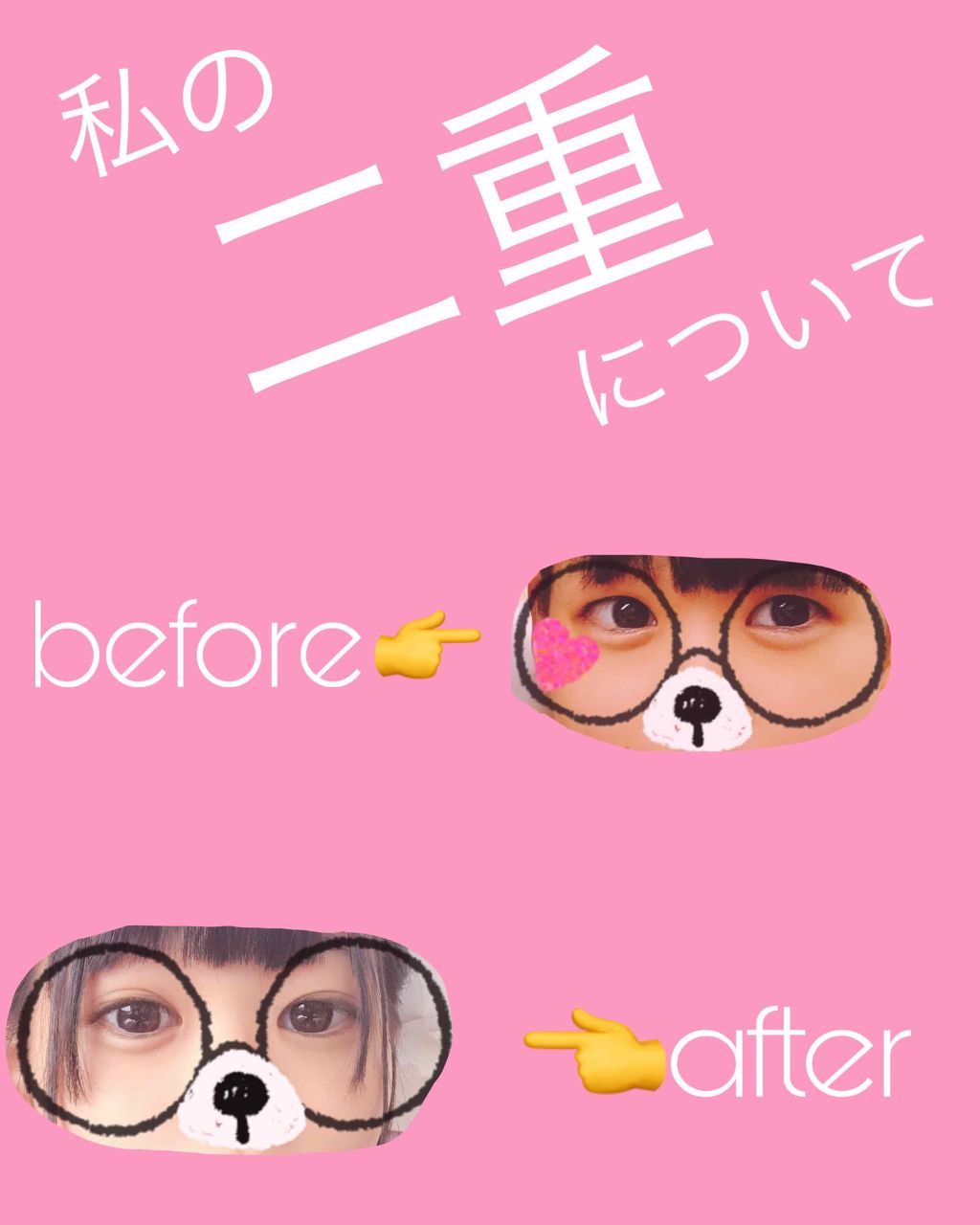 《二重になる方法》ダブルアイリキッド|automatic Beautyの使い方や二重メイク 奥二重 一重 アイプチ アイテープ By