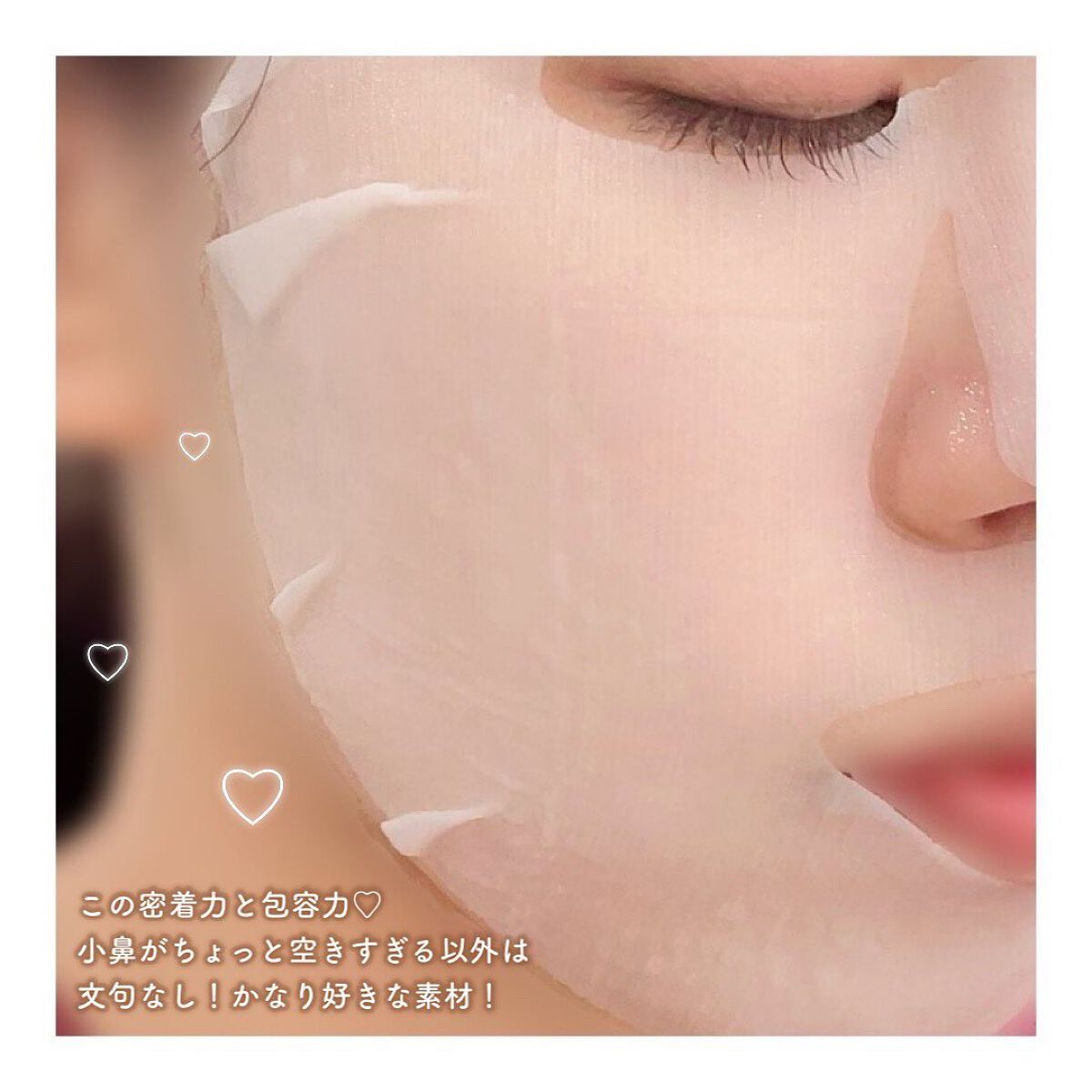 【限定シートマスク・パック】薬用ルルルン 美白アクネ|ルルルンの効果に関する口コミ ニキビケアにおすすめのシートマスク・パック