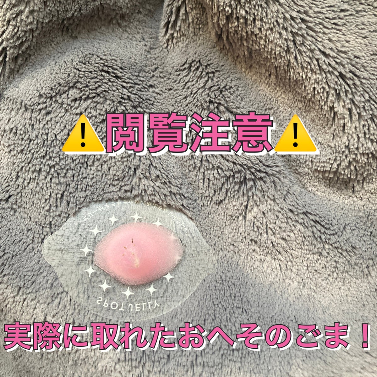 Spot Jelly(スポッ!とジェリー)へそごまパック|花王の口コミ 花王さまからいただきました Spot Jellyスポッ!とジェリー