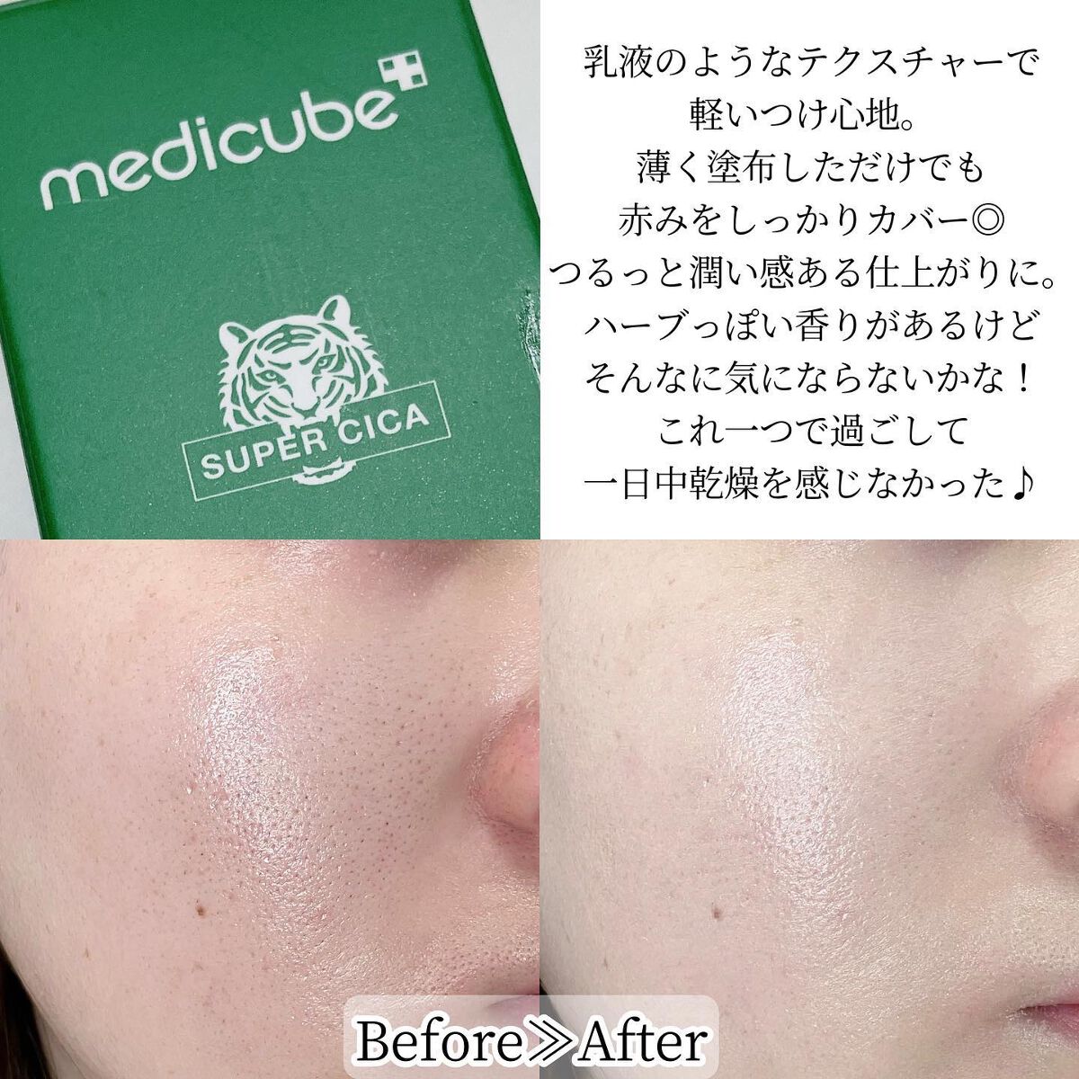 スーパーシカグリーントーンアップベース|medicubeの口コミ 敏感肌におすすめの化粧下地!メディキューブ スーパーシカトーンアップ