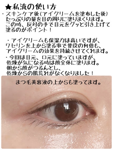 【試してみた】ヴァセリン オリジナル ピュアスキンジェリーのリアルな口コミ・レビュー Lips