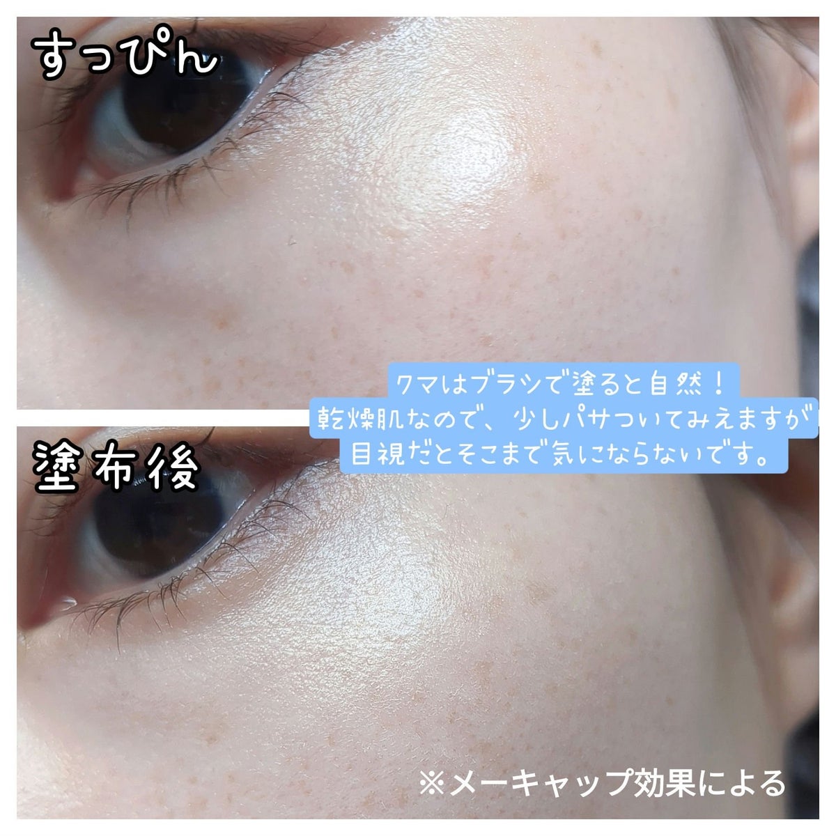 スポッツカバー ファウンデイション|shiseidoの口コミ ※汚肌ドアップあり⚠ 結局コレが強い🥹 By ブルベ夏みかん🍊敏感肌20