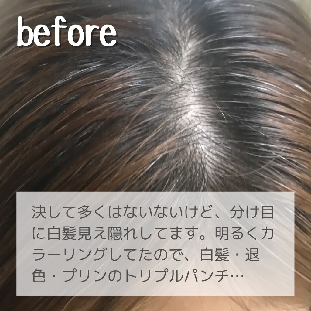 カラートリートメント|サイオスの口コミ ダークブラウンの口コミは多いけどライトブラ By くま子敏感肌 Lips